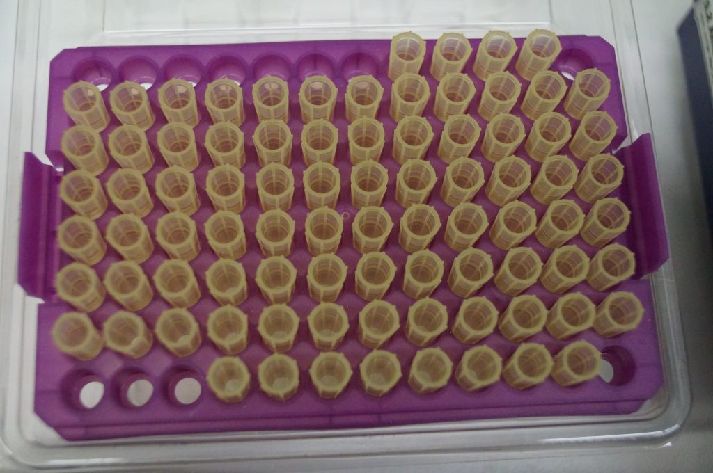 GM algae holds potential breakthrough in treating brain tumours - The ...