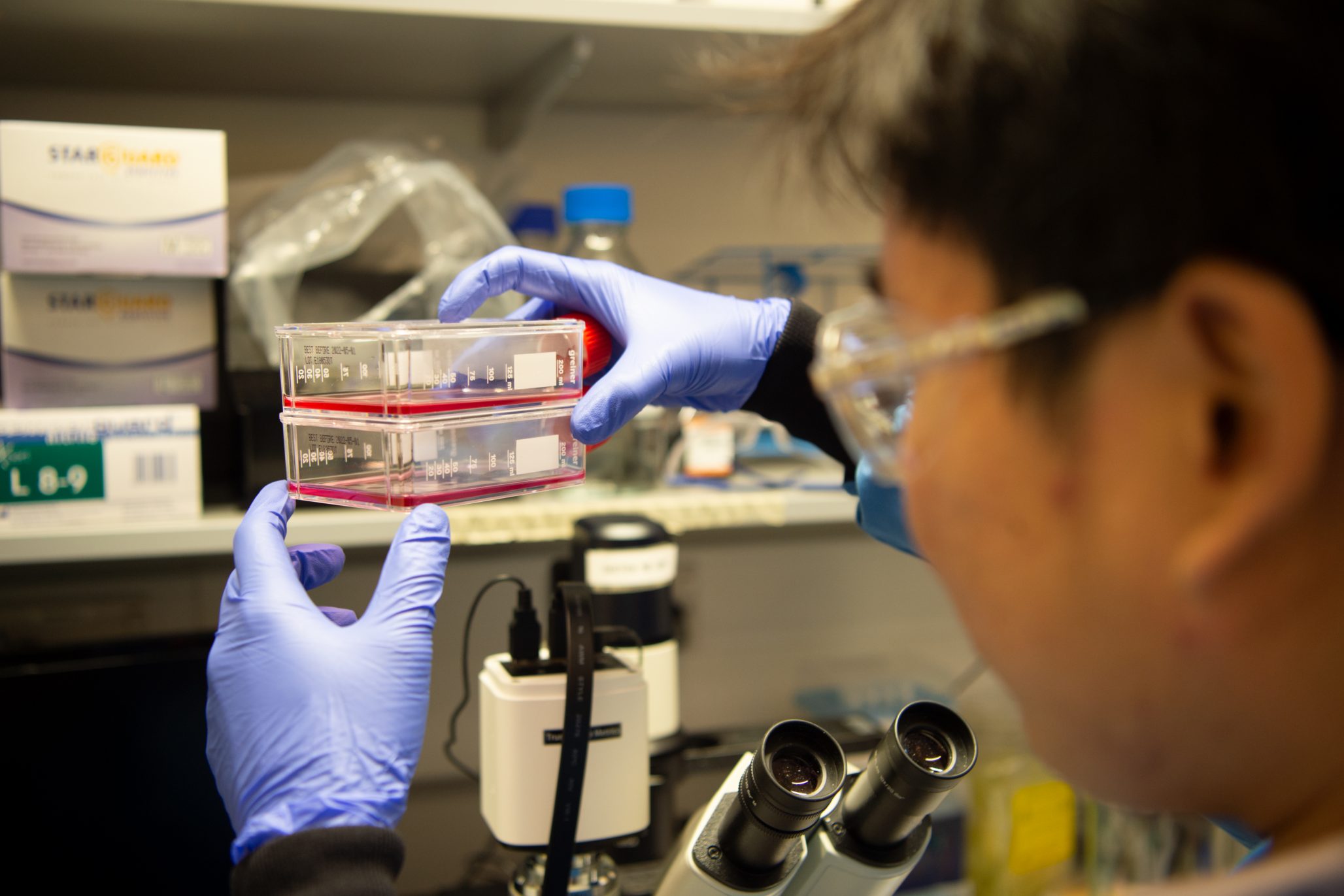 Our researchers develop new test to assess drugs to tackle childhood ...